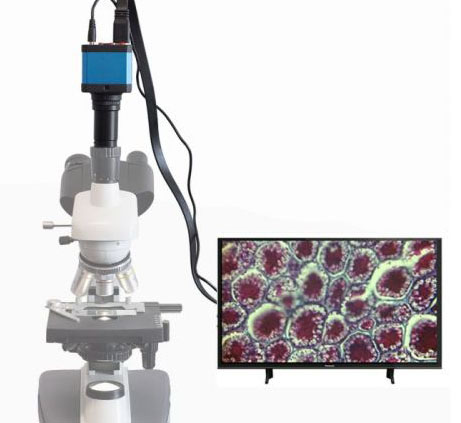 The key differences between an optical microscope and a digital ...